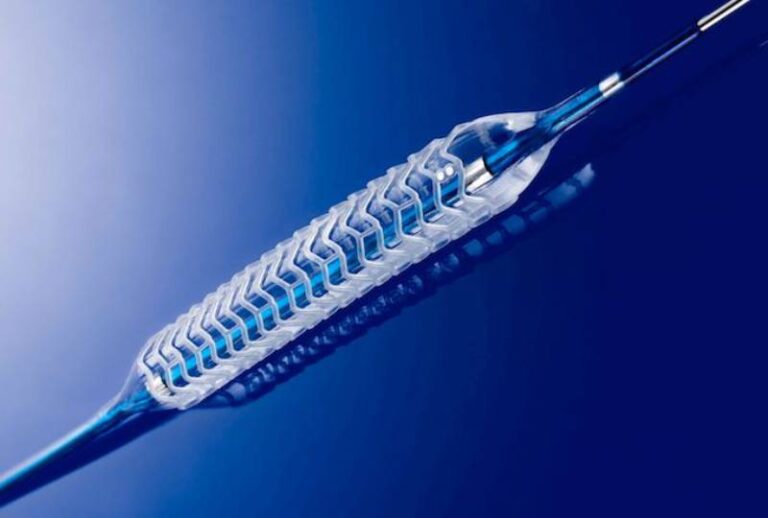 Stent Là Gì? Cơ Chế Hoạt Động Ra Sao Khi Đưa Vào Cơ Thể Người - Bệnh ...